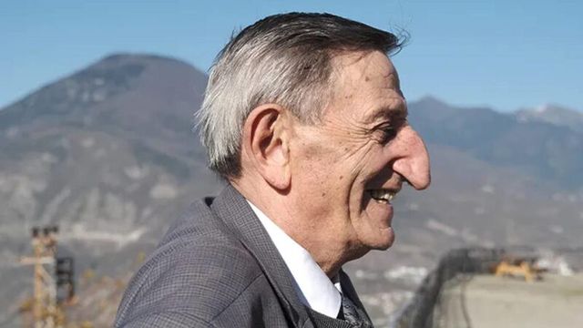 El hombre más narigón del mundo asegura que su nariz “es una bendición”