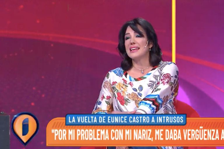 Eunice Castro: “Por el problema con mi nariz, me daba vergüenza aparecer”