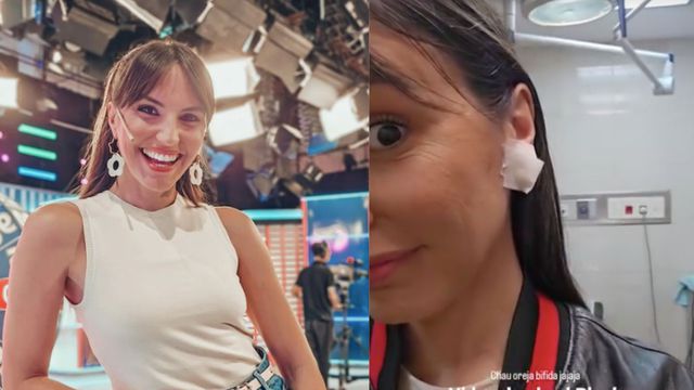 Leti Fernández Feijoo compartió el resultado de su cirugía plástica en ...